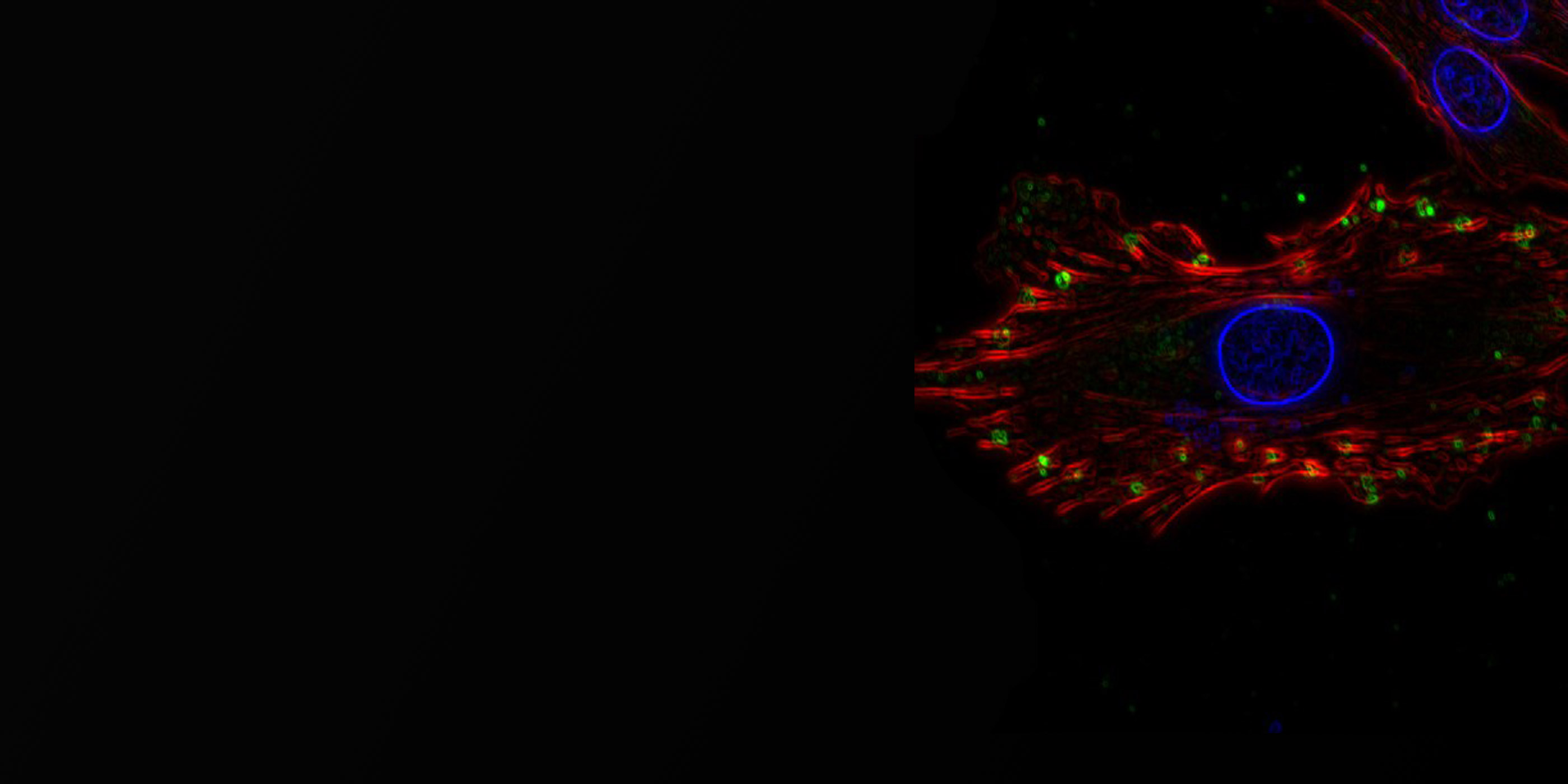 Philippe P. Roux | IRIC - Institute for Research in Immunology and Cancer